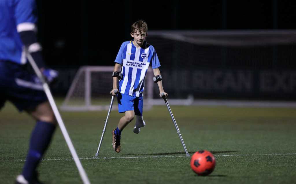 Charlie - "I want to be the best amputee footballer in the world ...